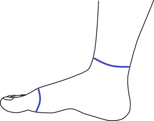 Sock Skills: Tweaking the Fit of a Short-Row Heel – Modern Daily Knitting